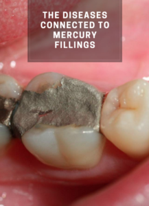 Mercury Fillings & Implants Removals - Holistic Biological Dentistry ...